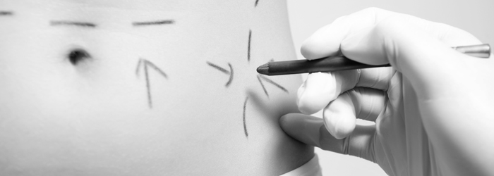 Via liposuctie vetophopingen wegnemen, de contour van uw lichaam verbetert.
